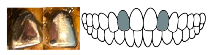 Composite sketch released of unidentified man found dead near Officers Gulch as coroner’s office ...